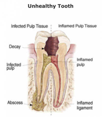 Root canal treatment – Dr Fergus Duddy Endodontics